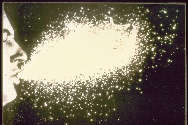 Influenza Images | Immunize.org