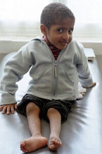 Polio Images | Immunize.org