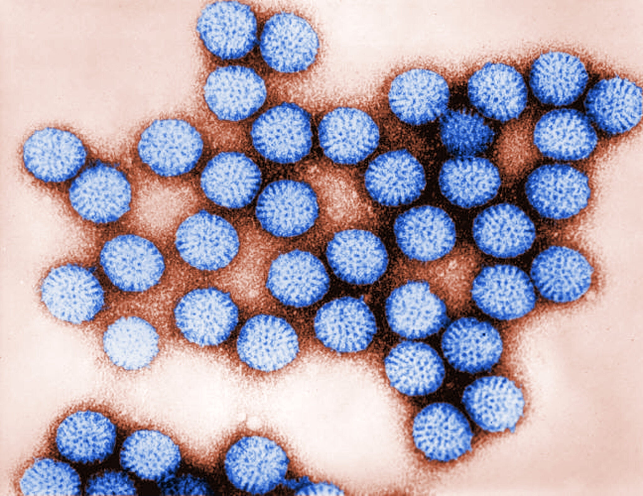 Rotavirus Images | Immunize.org
